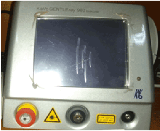 Gallium Arsenide Aluminium Laser in Esthetic Dentistry