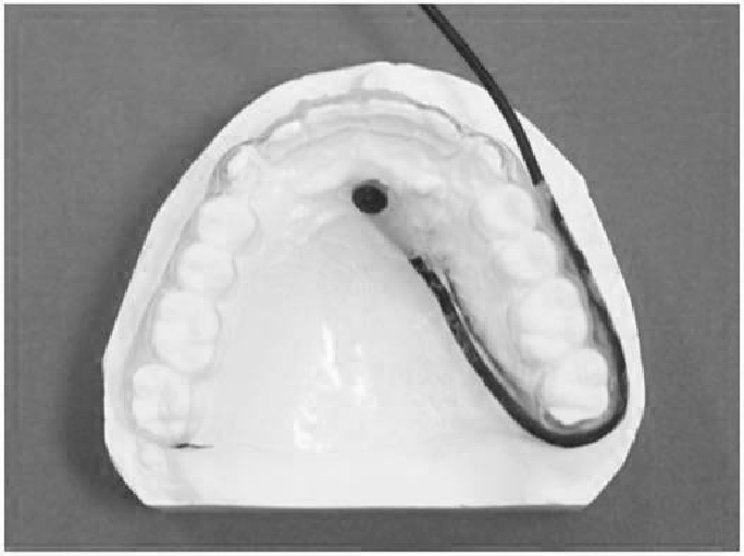 Simultaneous Evaluation of Three-Dimensional Lip Kinetics and Tongue ...