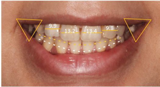 Treatment Phasing: A Simplified Approach for Complex Case Management