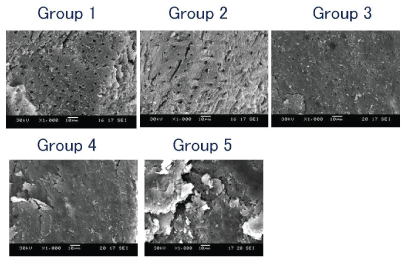 Evaluation of the Caries Removal Efficacy of Several Organic Acid Reagents