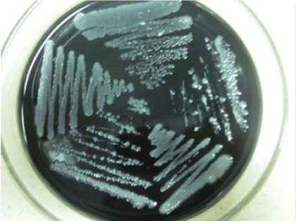 Detection of Campylobacter spp. from Poultry and Poultry Products in ...