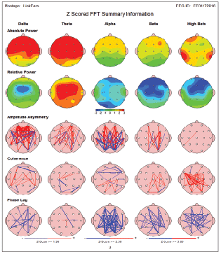 Masgutova Neurosensorimotor Reflex Integration (MNRI) Neuromodulation ...