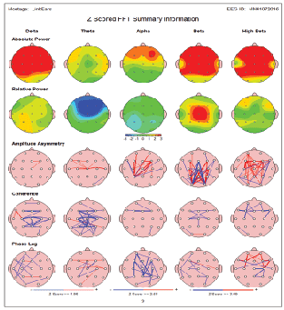 Masgutova Neurosensorimotor Reflex Integration (MNRI) Neuromodulation ...