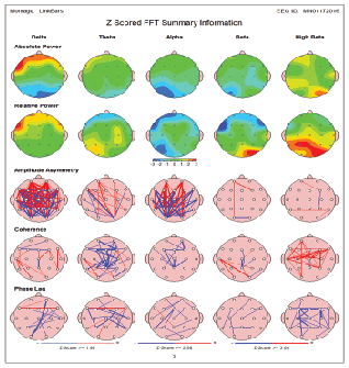 Masgutova Neurosensorimotor Reflex Integration (MNRI) Neuromodulation ...