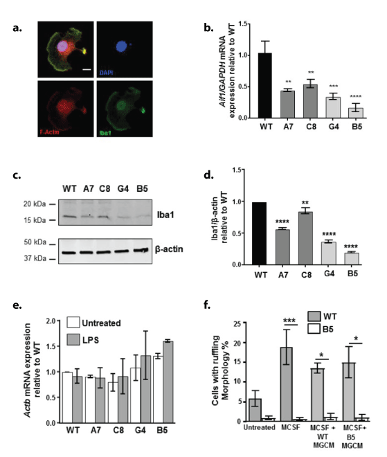 Loss of Function of TREM2 Results in Cytoskeletal Malfunction in Microglia