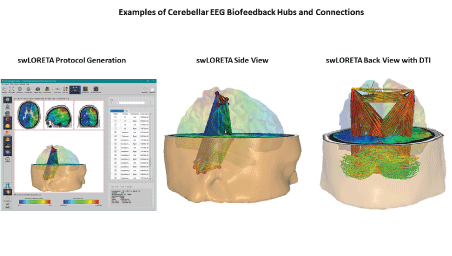 New Advances in Electrical Neuroimaging, Brain Networks and Neurofeedback Protocols