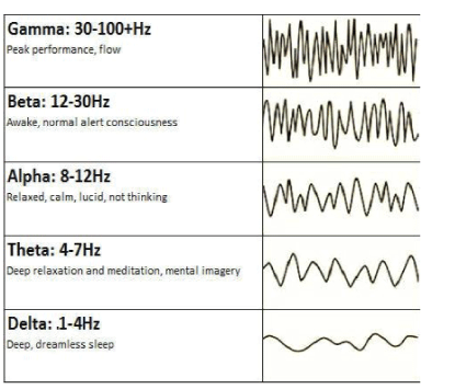 Effect of the MNRI Reflex Neuromodulation on the QEEG and ...