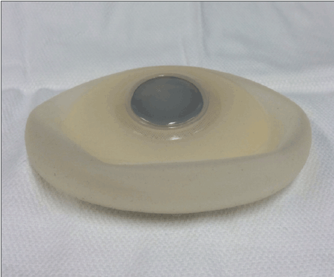 Breast Implants–Current Insights on a Common Medical Device