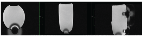 Does Electronic Identification Enablement for Silicone Gel Implants ...