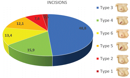 Systematization of the Incisions in Nipple-Sparing Mastectomy