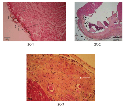 Heart Lesion Repair by Fetal Heart Implantation and Chitosan Flap in Rats